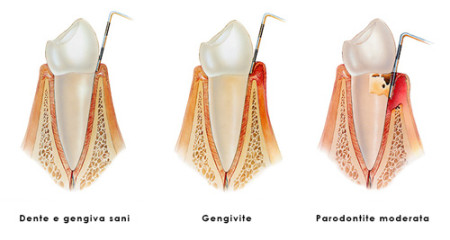Alarm bell: movable teeth | Sanident