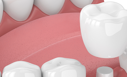 Dentista Milano e Studio Odontoiatrico | Sanident